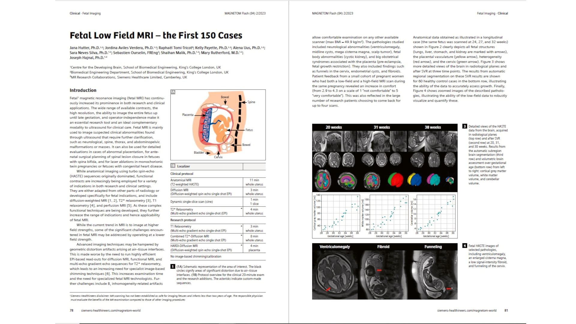 Lower-field MRI