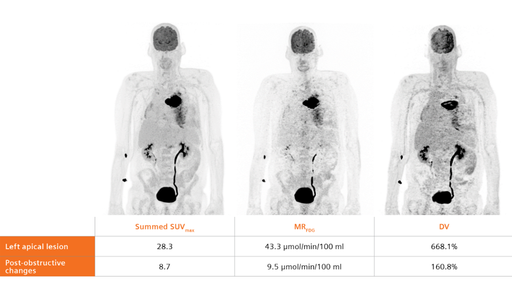 Biograph Vision PET/CT Clinical Image Gallery - Siemens Healthineers