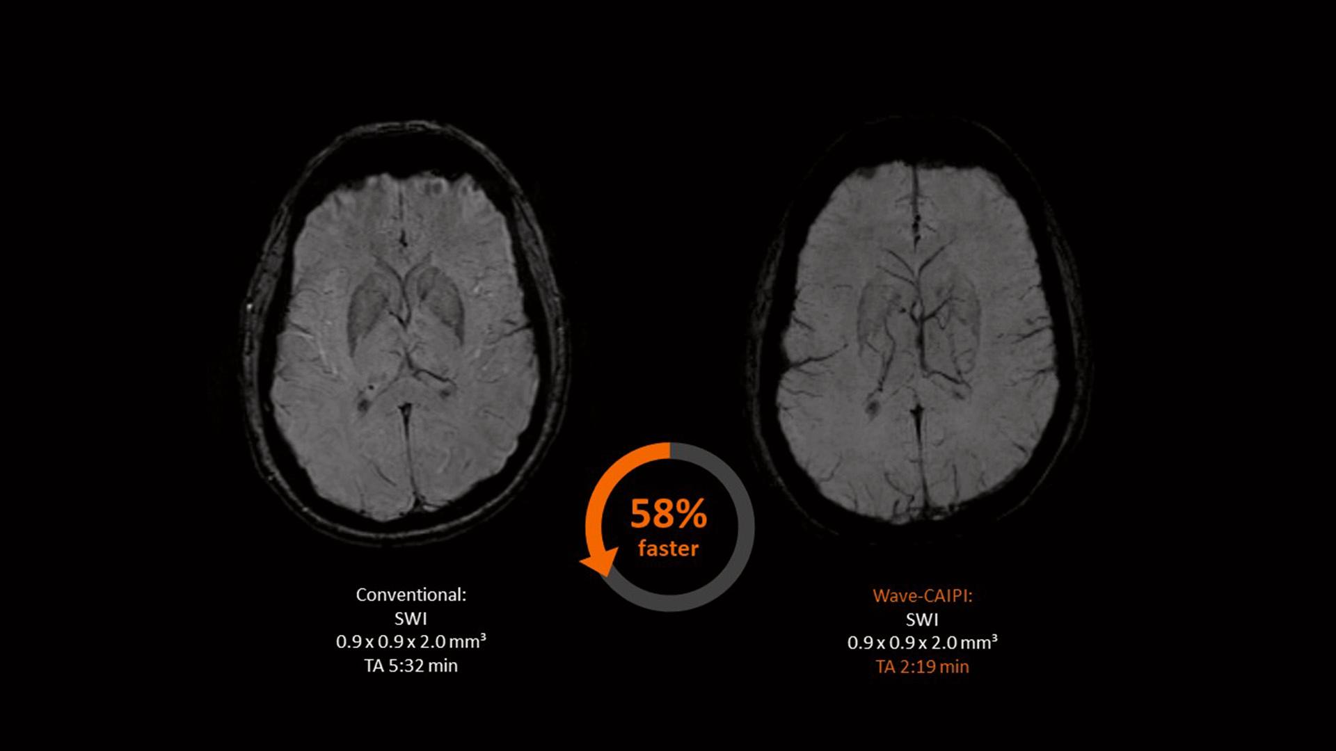 MAGNETOM Viato.Mobile - Siemens Healthineers