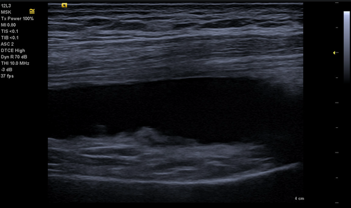 MSK Ultrasound