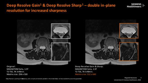 Deep Resolve in MRI