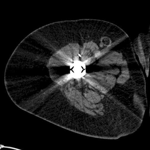 iMAR - Siemens Healthineers Schweiz