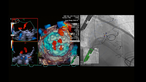 High Tech Cardio - Siemens Healthineers