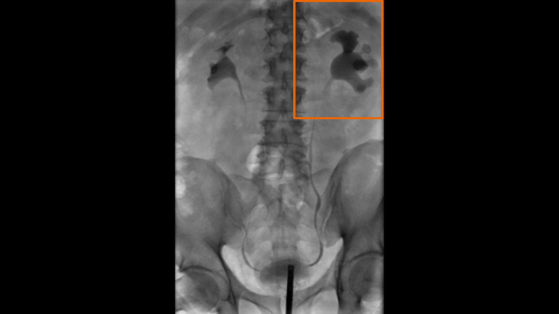 Urology device Uroskop Omnia Max - Siemens Healthineers
