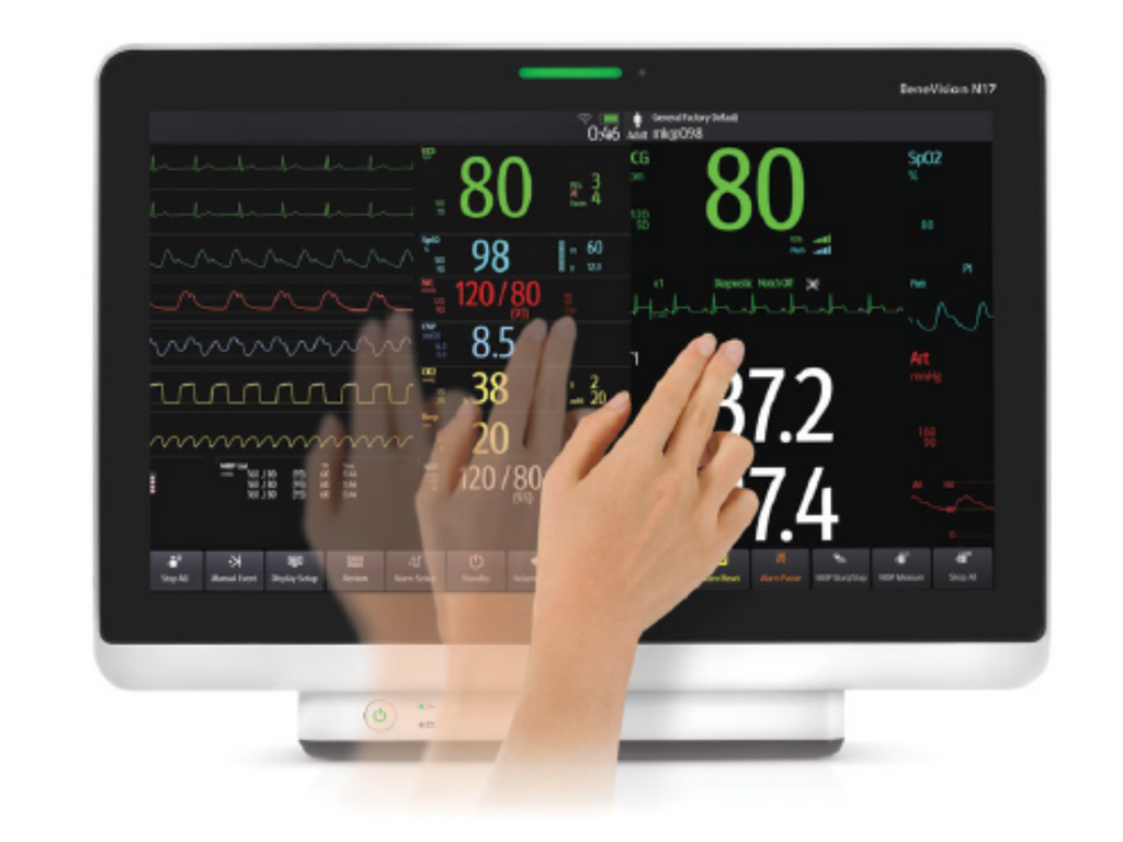 Mindray Patient Monitors - Siemens Healthineers USA