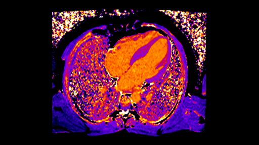 MR imaging in sports medicine - Siemens Healthineers