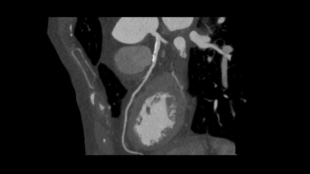Dual Source CT - Siemens Healthineers Croatia