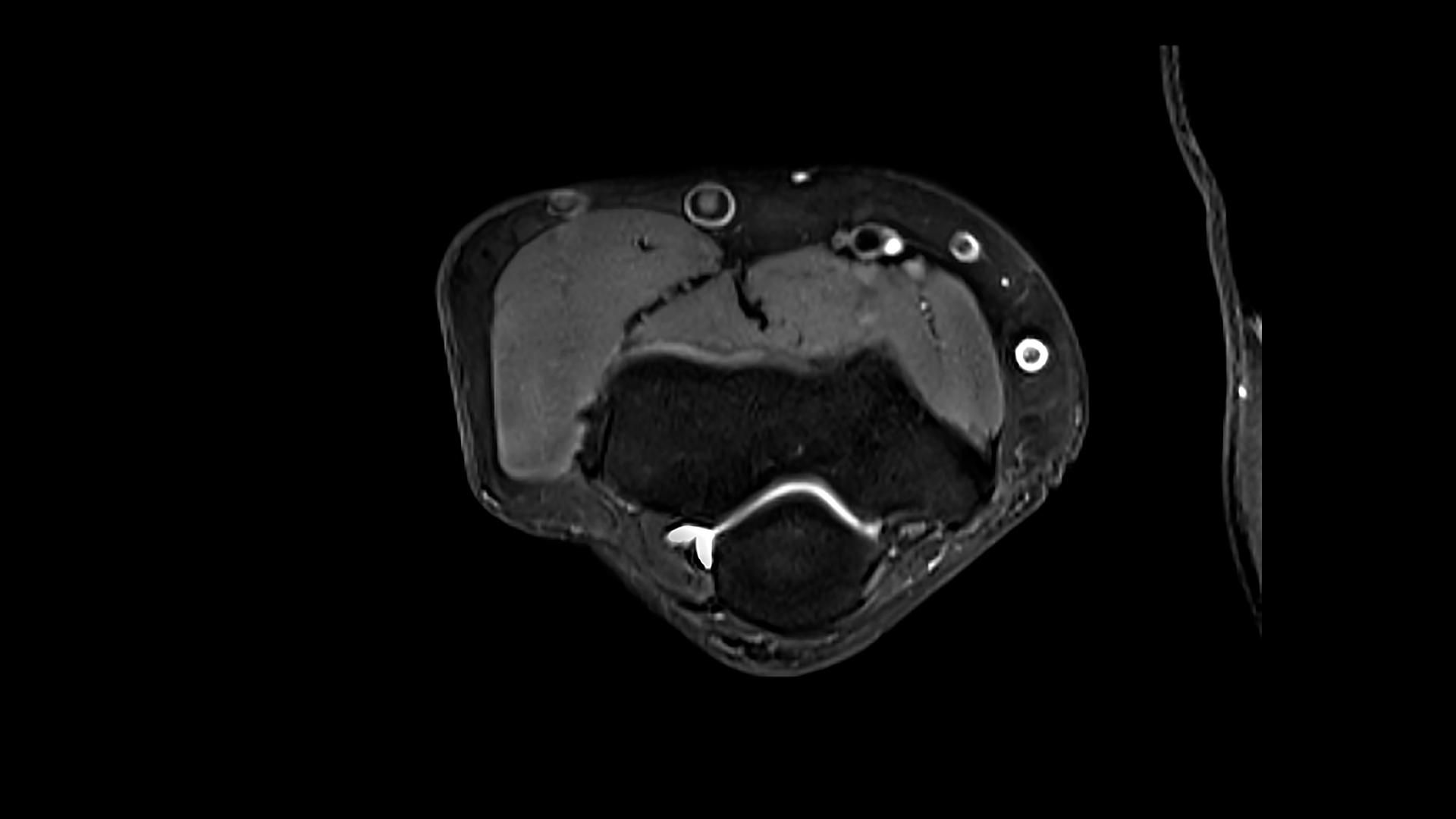 Phoenix Images for MAGNETOM Sola 1.5T