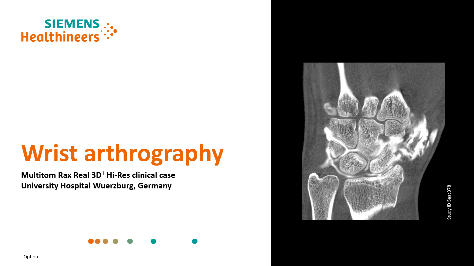 Robotic X-Ray - Clinical Case Library - Siemens Healthineers