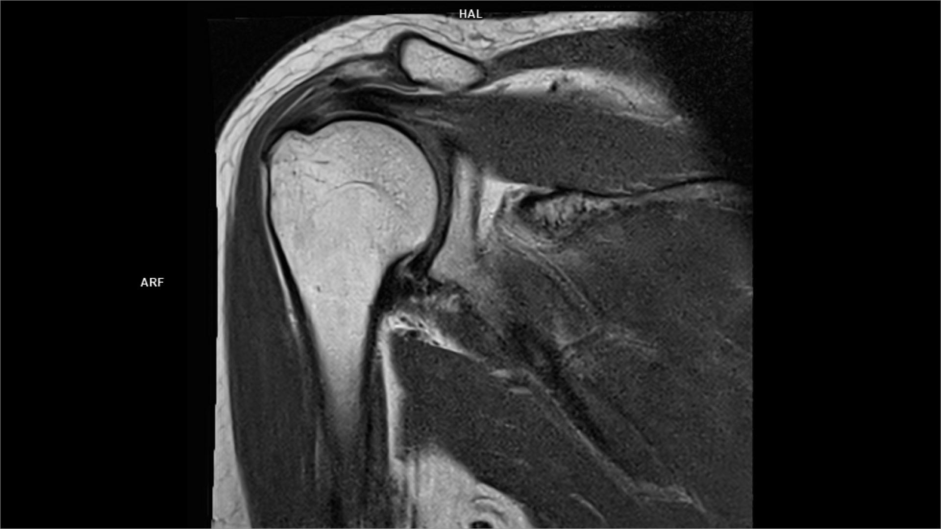 Coronal PD-MAGNETOM Free.Max - Siemens Healthineers USA