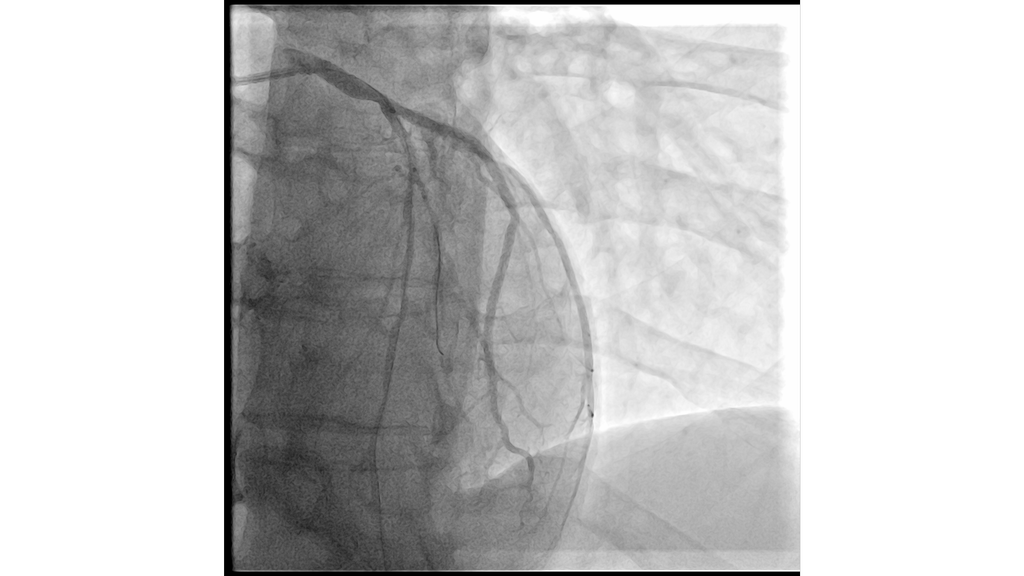 Superior Image Quality. Same Ultra-Low Dose - Siemens Healthineers USA