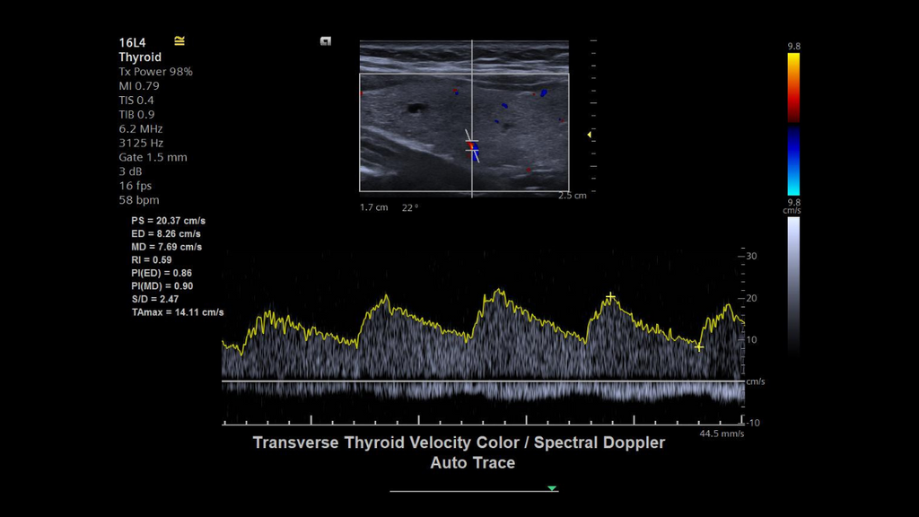 ACUSON Maple is a High-Performance Shared Service Ultrasound System ...