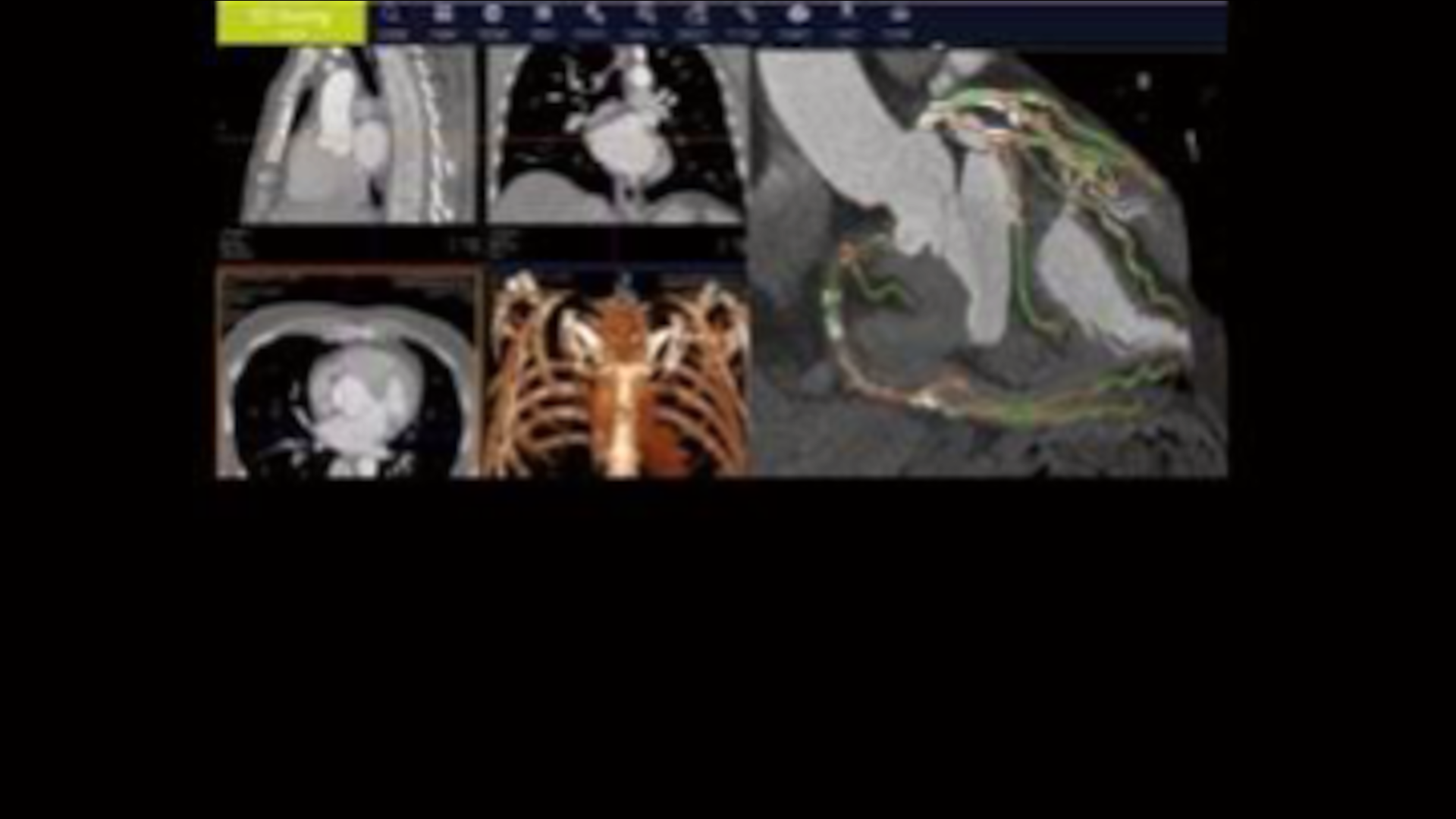 ExpertGuidance - Siemens Healthineers