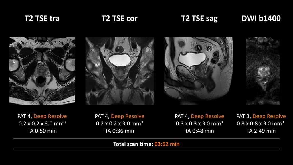 MAGNETOM Cima.X Fit - Siemens Healthineers
