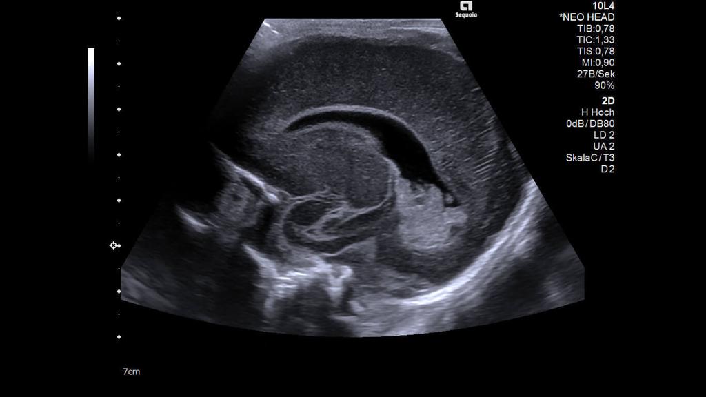 Pediatric Ultrasound System - Siemens Healthineers USA