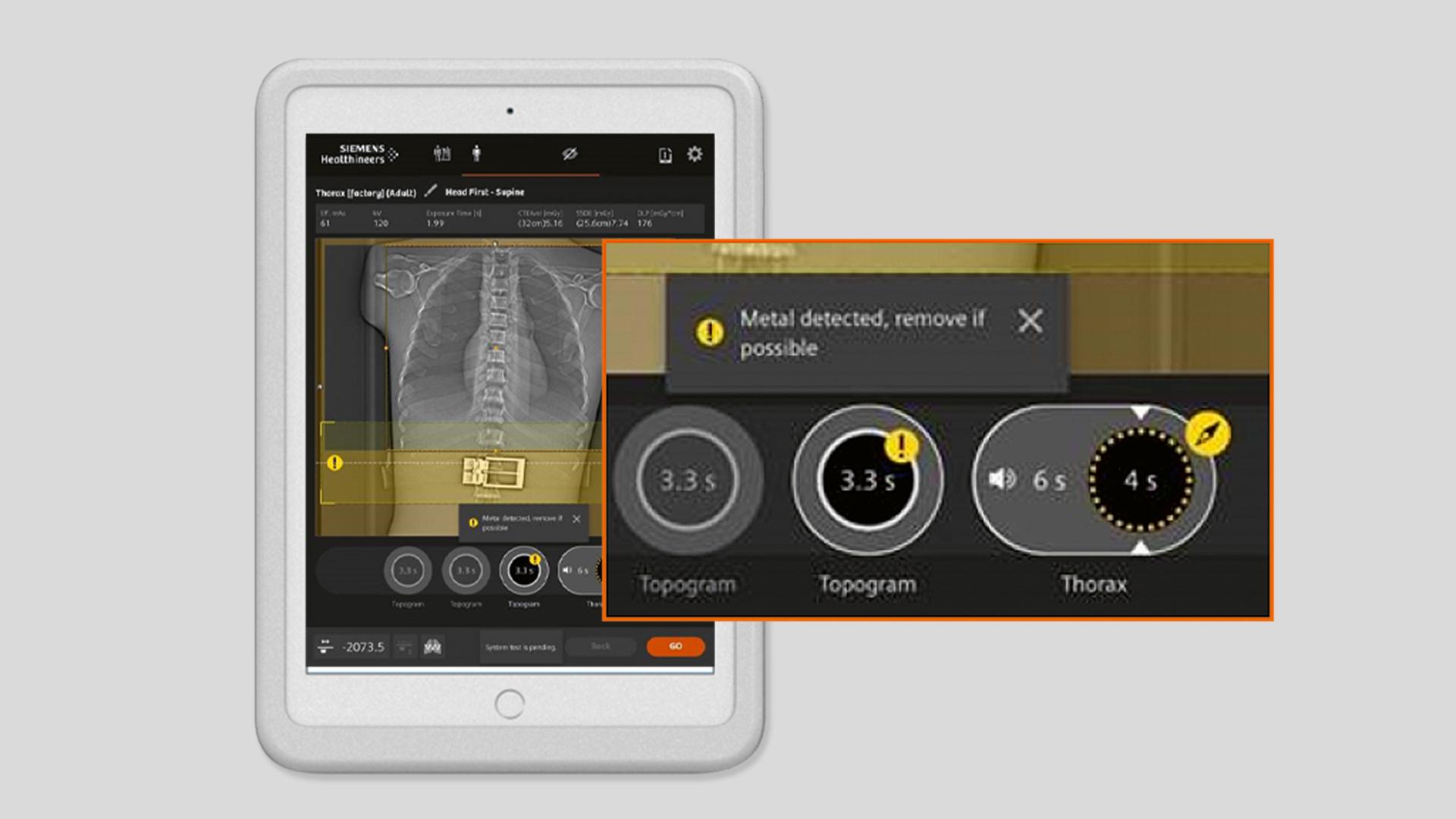 SOMATOM go.Top com myExam Companion - Siemens Healthineers Brasil