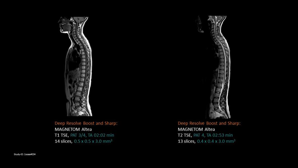 Deep Resolve - Siemens Healthineers