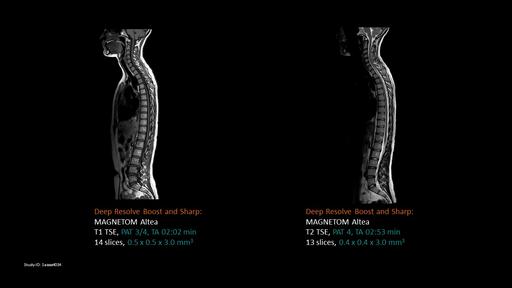 Deep Resolve - Siemens Healthineers