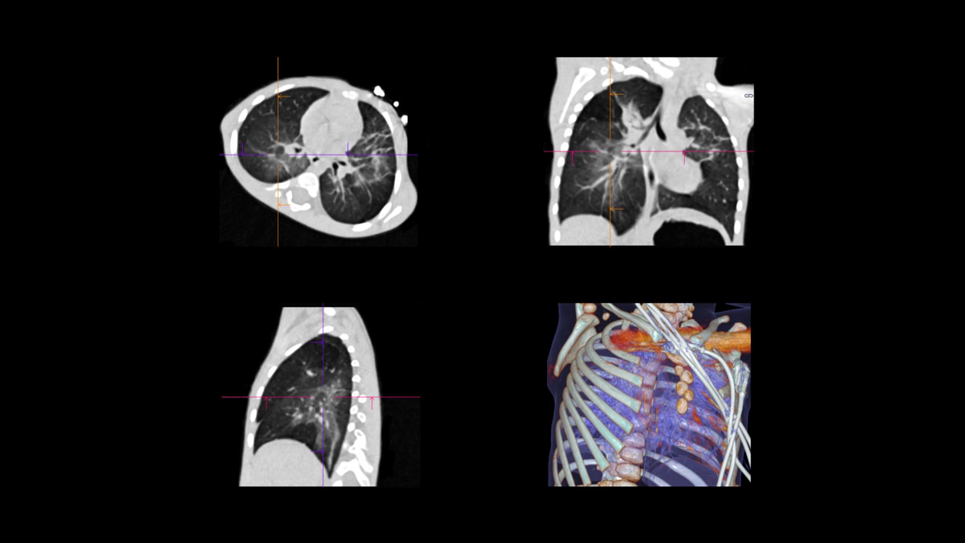 SOMATOM Drive eco – CT Scanner - Siemens Healthineers