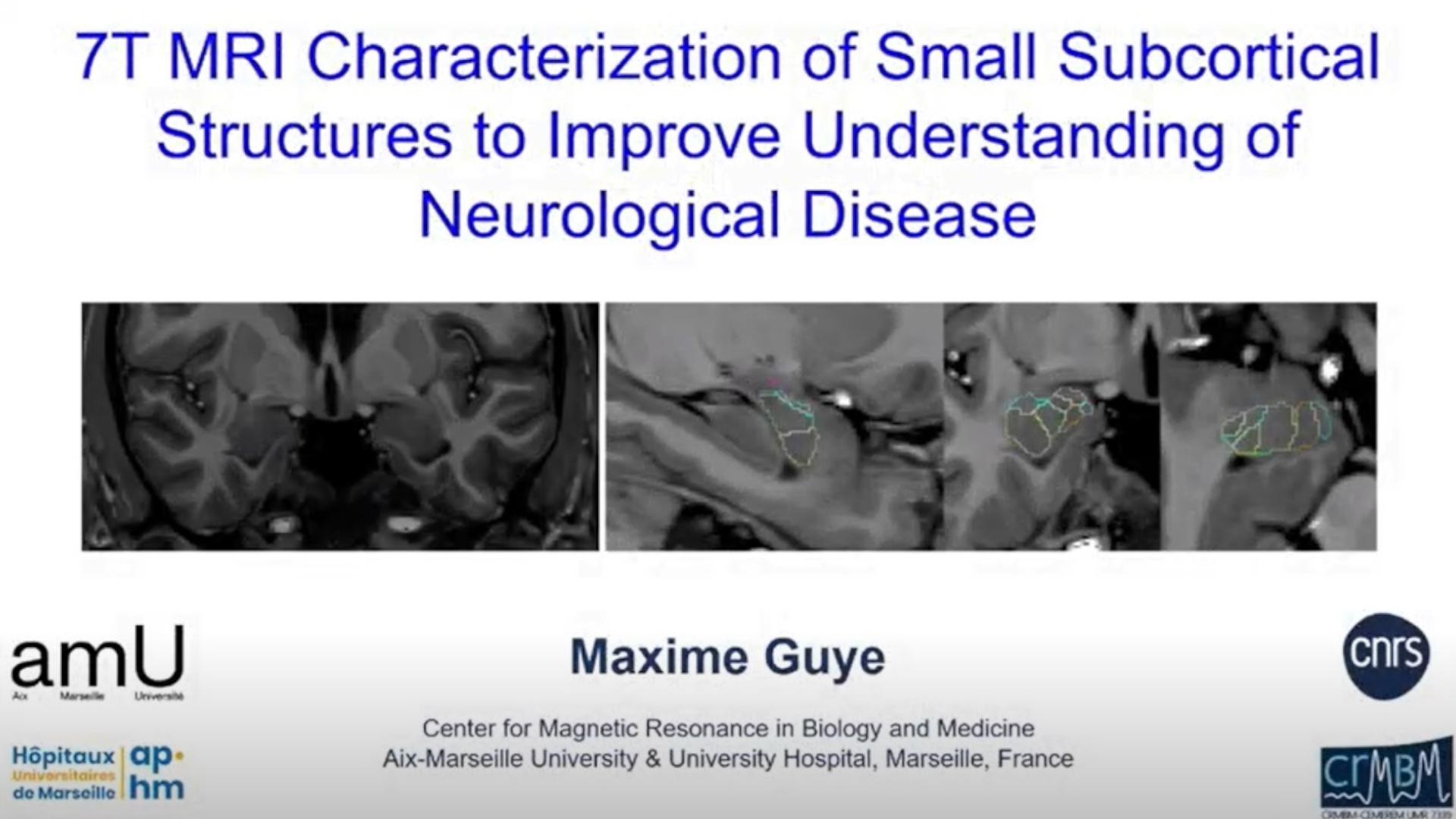 7T MRI Characterization of Small Subcortical Structures