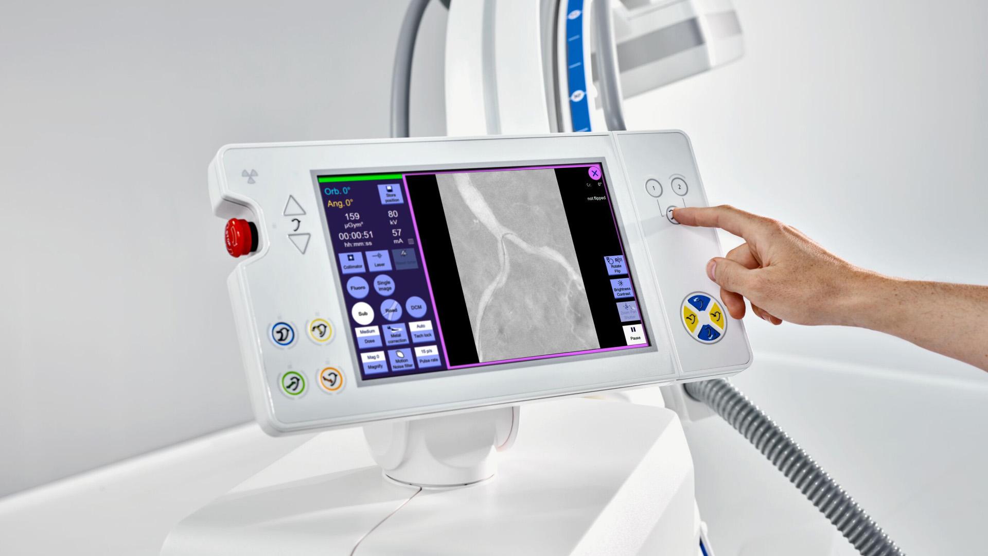 Case Study: PTA of External Iliac - Siemens Healthineers USA