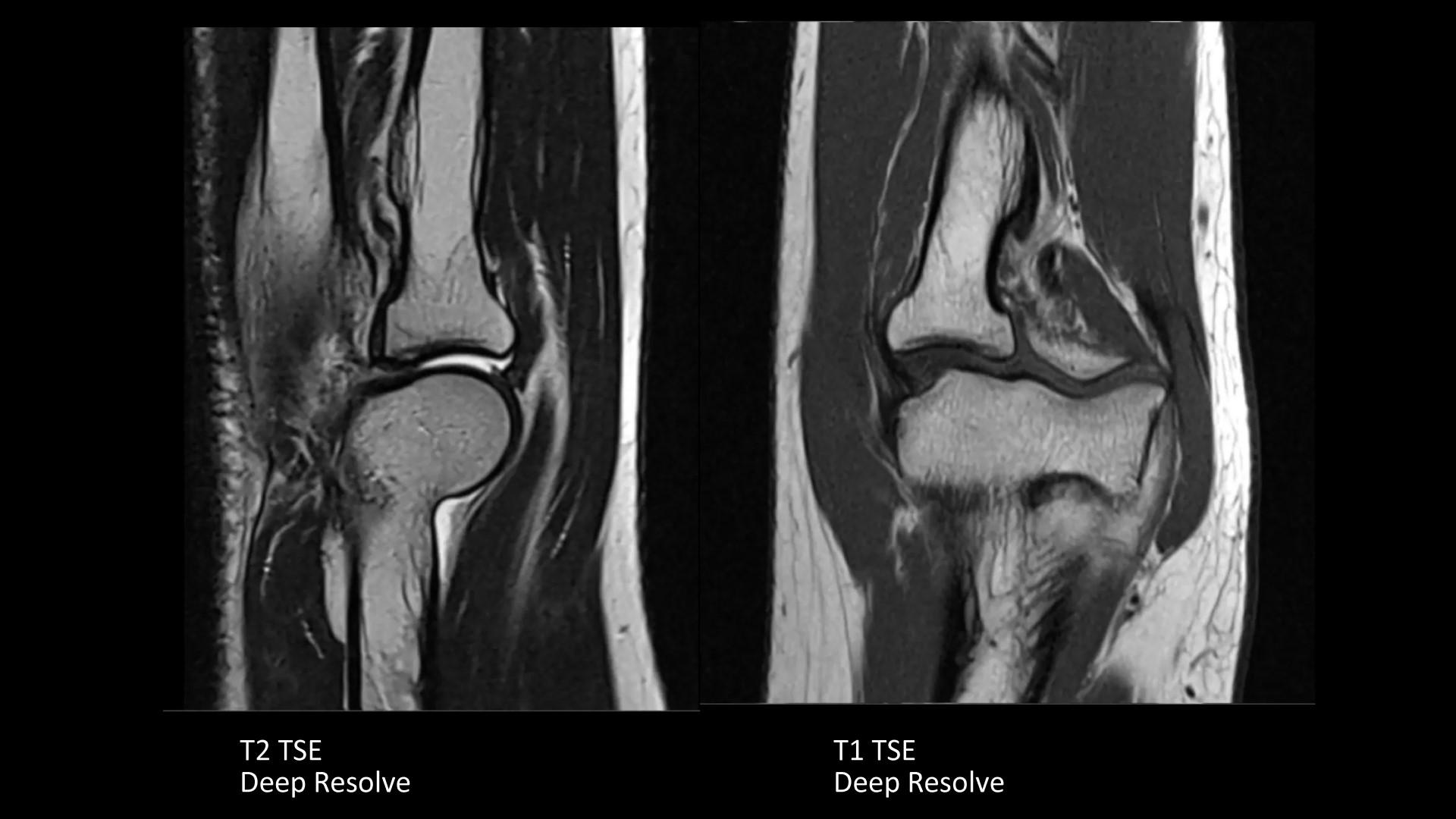 BioMatrix Contour Coils - Siemens Healthineers