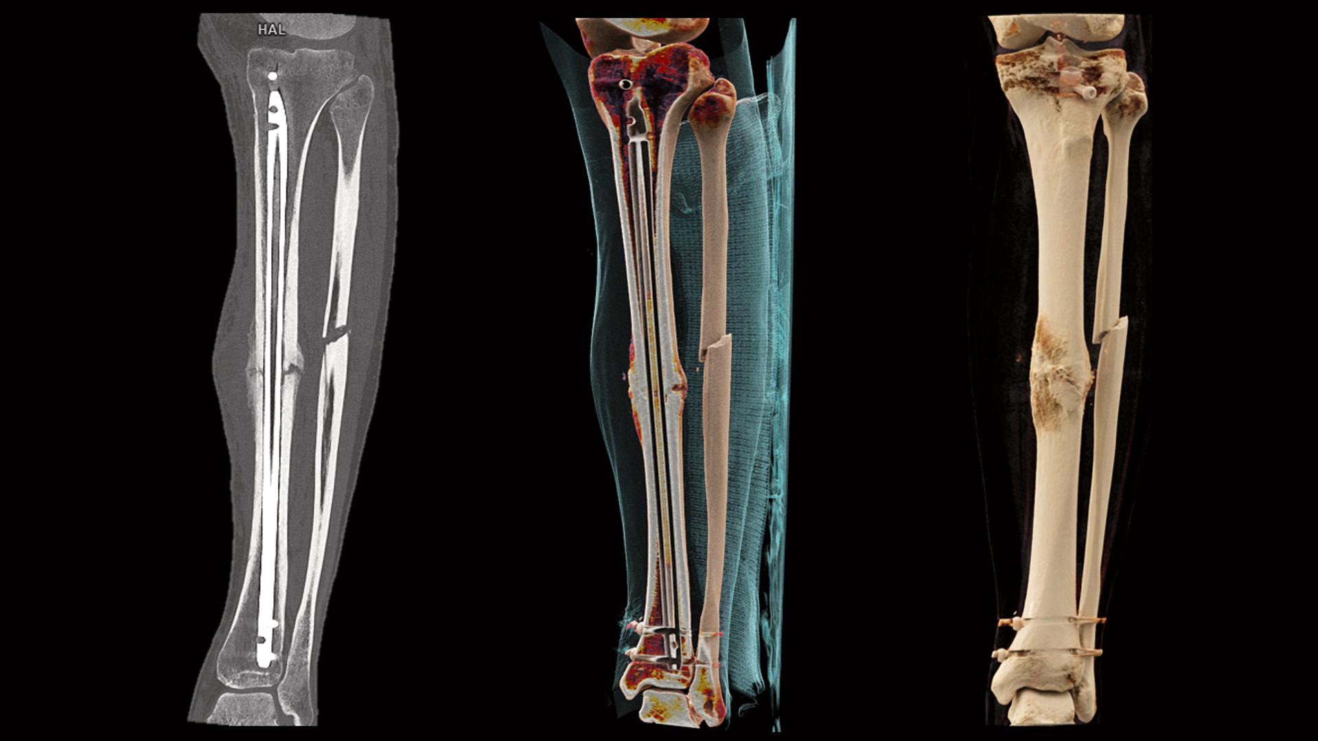 The Siemens Healthineers CT Imaging Chain - Siemens Healthineers