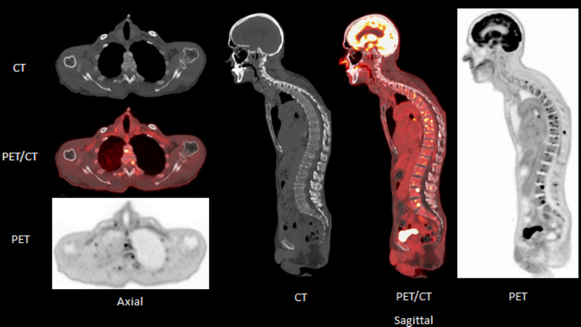 A Champion Of PET Innovation - Siemens Healthineers USA