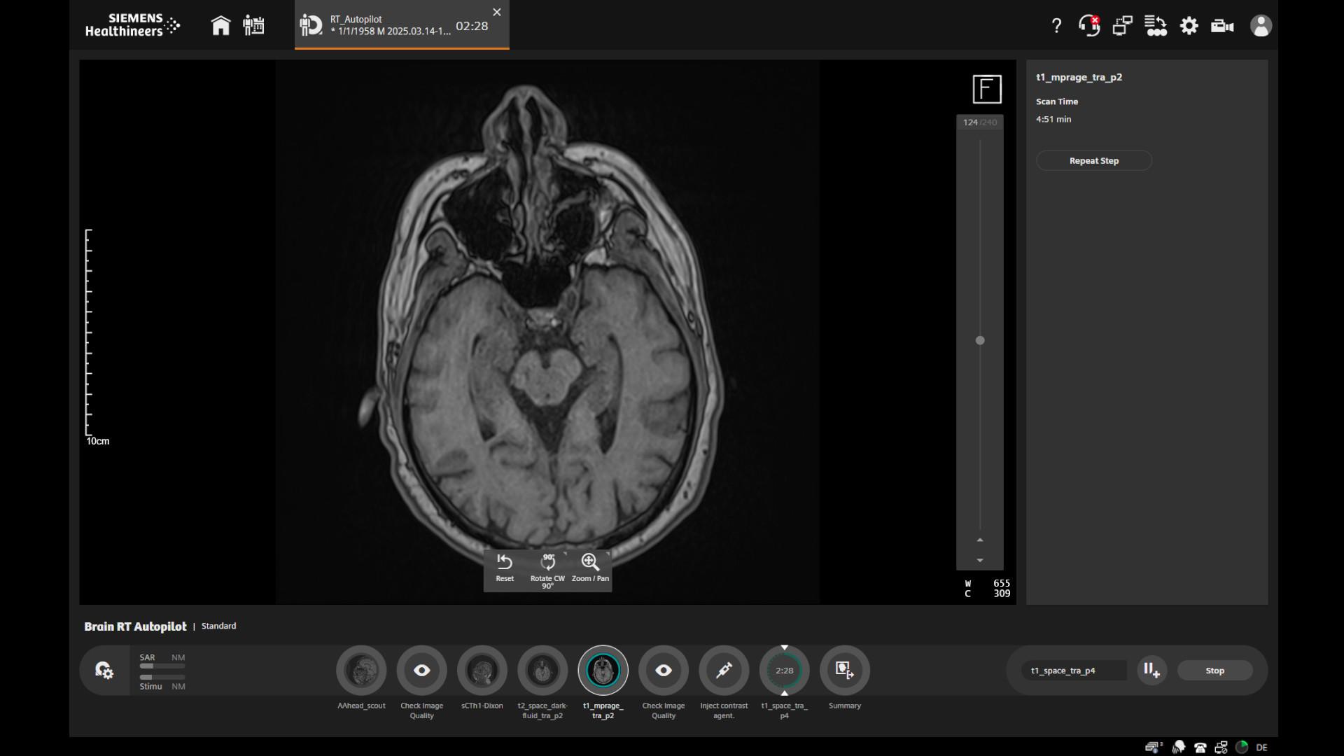 MAGNETOM Flow RT Pro Edition