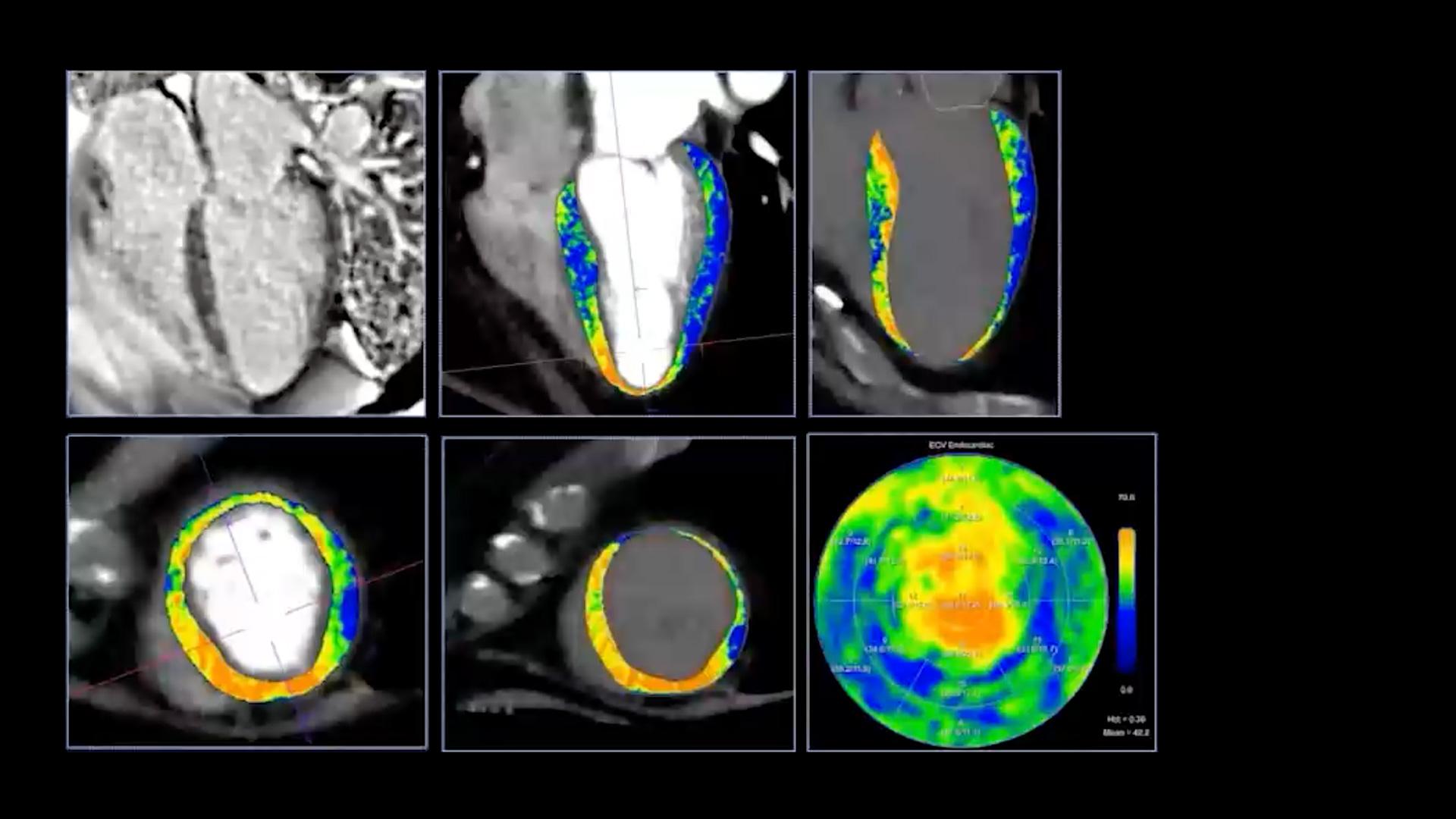 PCCT scientific evidence - Siemens Healthineers