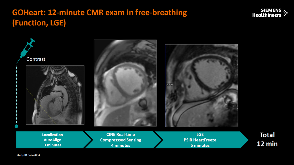 Cardiac Dot Engine - Siemens Healthineers India