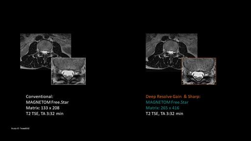 Deep Resolve - Siemens Healthineers Japan