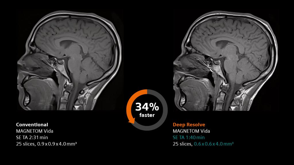 Deep Resolve - Siemens Healthineers