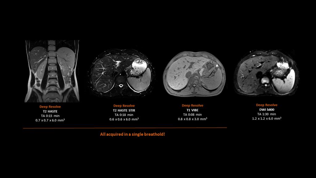 MAGNETOM Flow. Platform - Siemens Healthineers