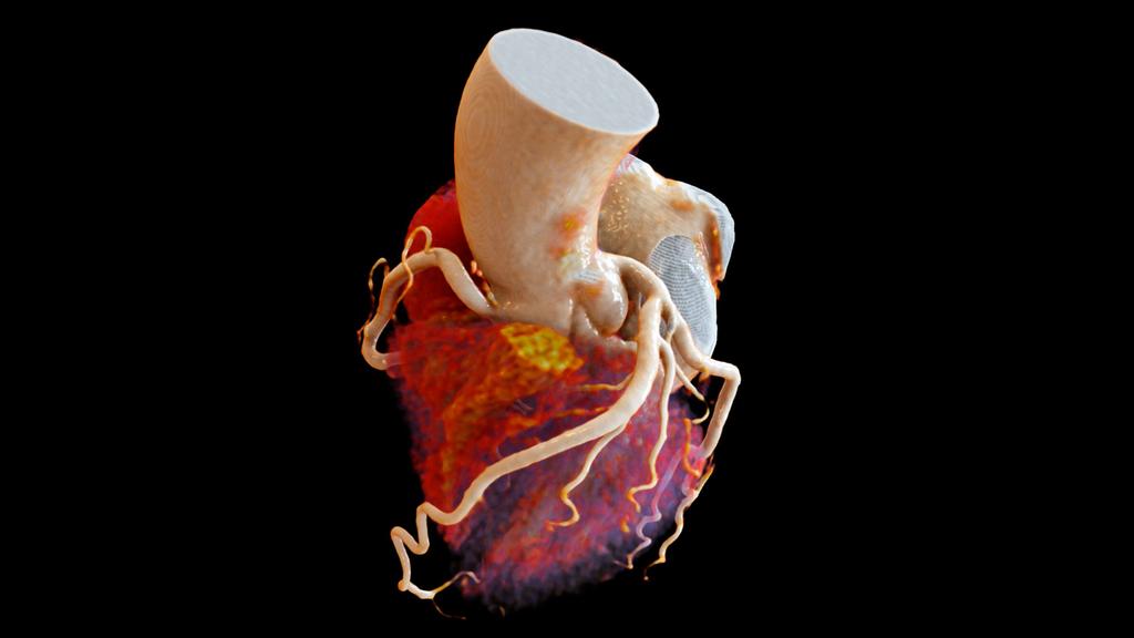 Cinematic Rendering in medical imaging - Siemens Healthineers