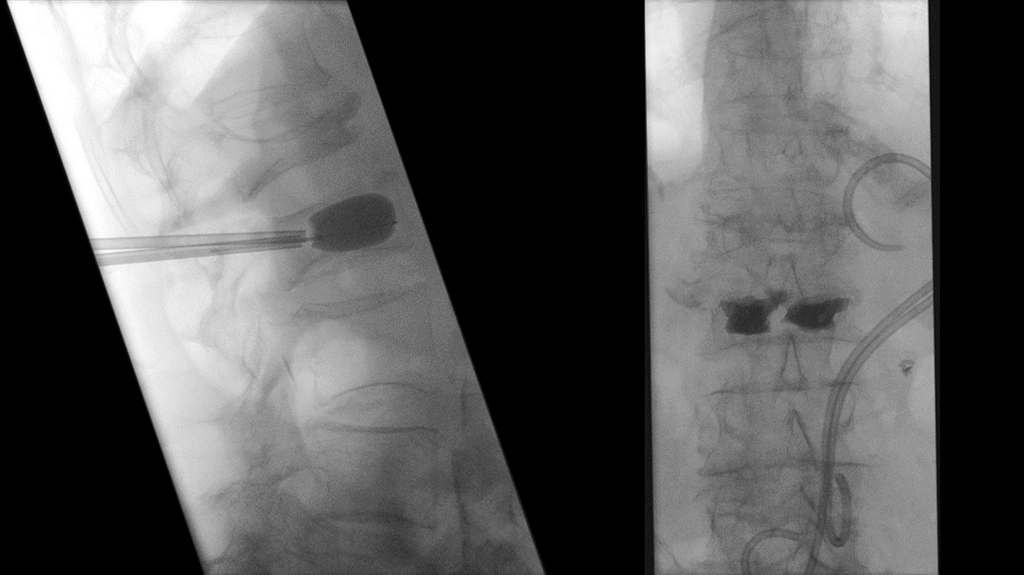 Mobile C-arm machine - CIARTIC Move - Siemens Healthineers