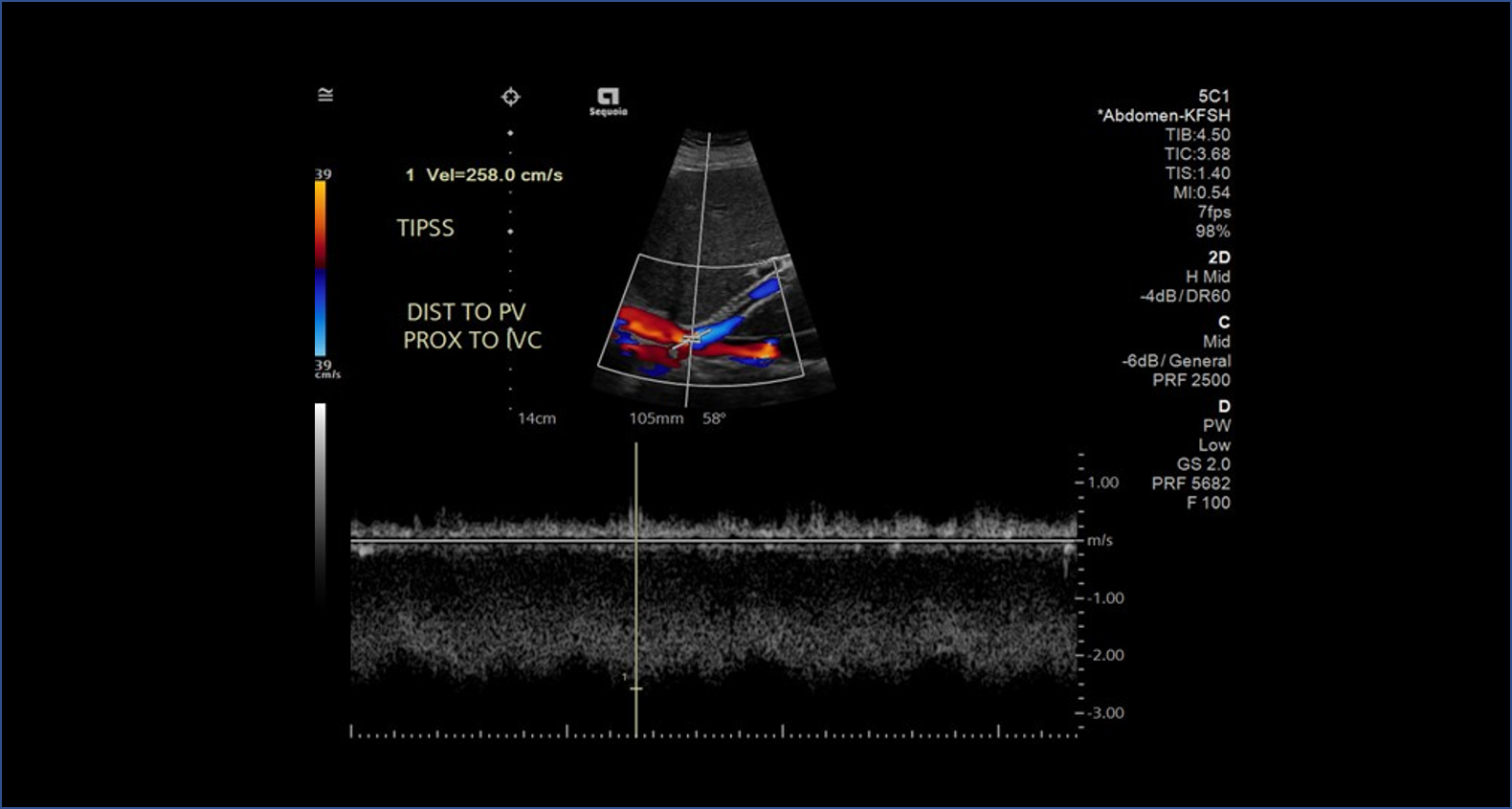 New Technologies help in Rare Ultrasound Case Studies