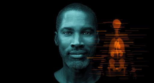 Autocontouring in radiation therapy - Siemens Healthineers - Siemens ...