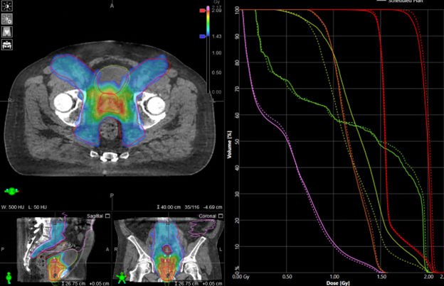 Changing the way we think about radiation delivery