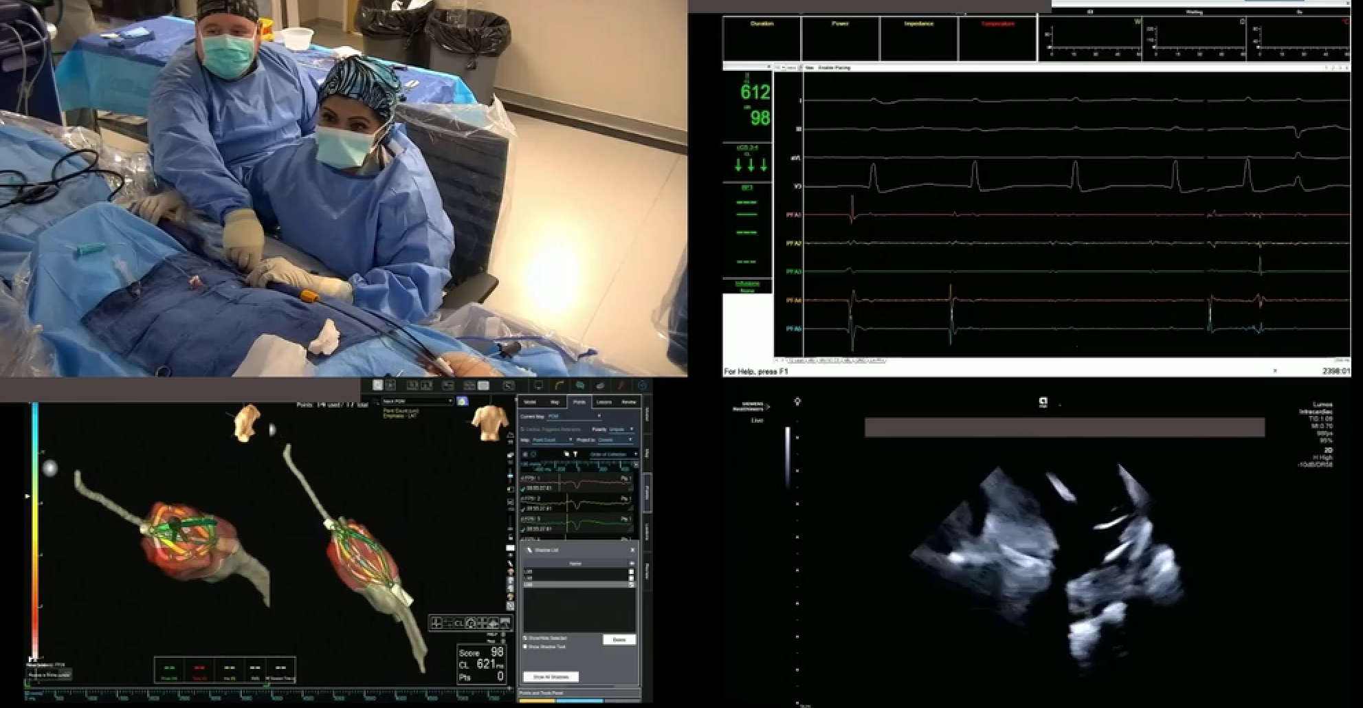 Ultrasound Machines - Siemens Healthineers