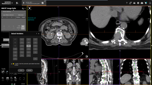 syngo.via RT Image Suite - Siemens Healthineers