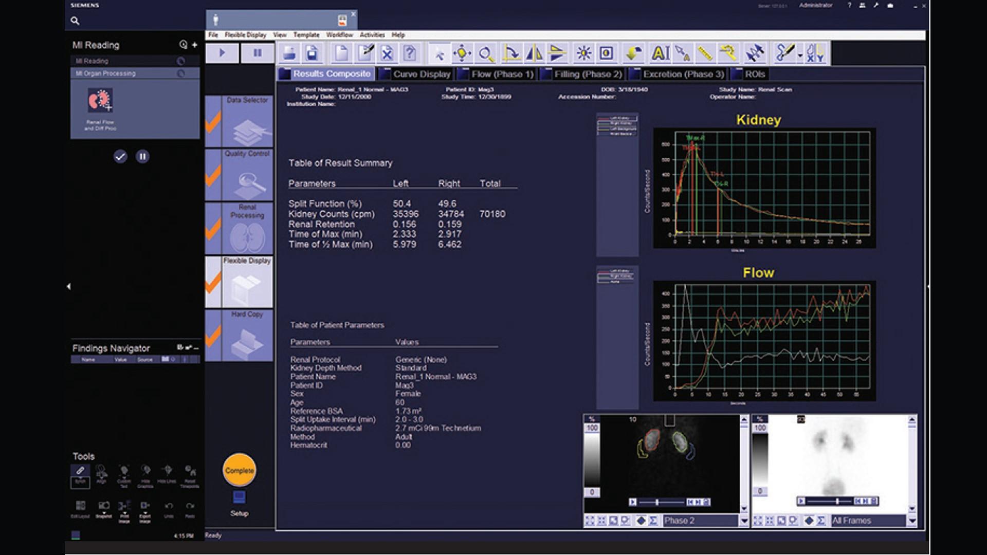 syngo.via pour l'Imagerie Moléculaire - Siemens Healthineers France