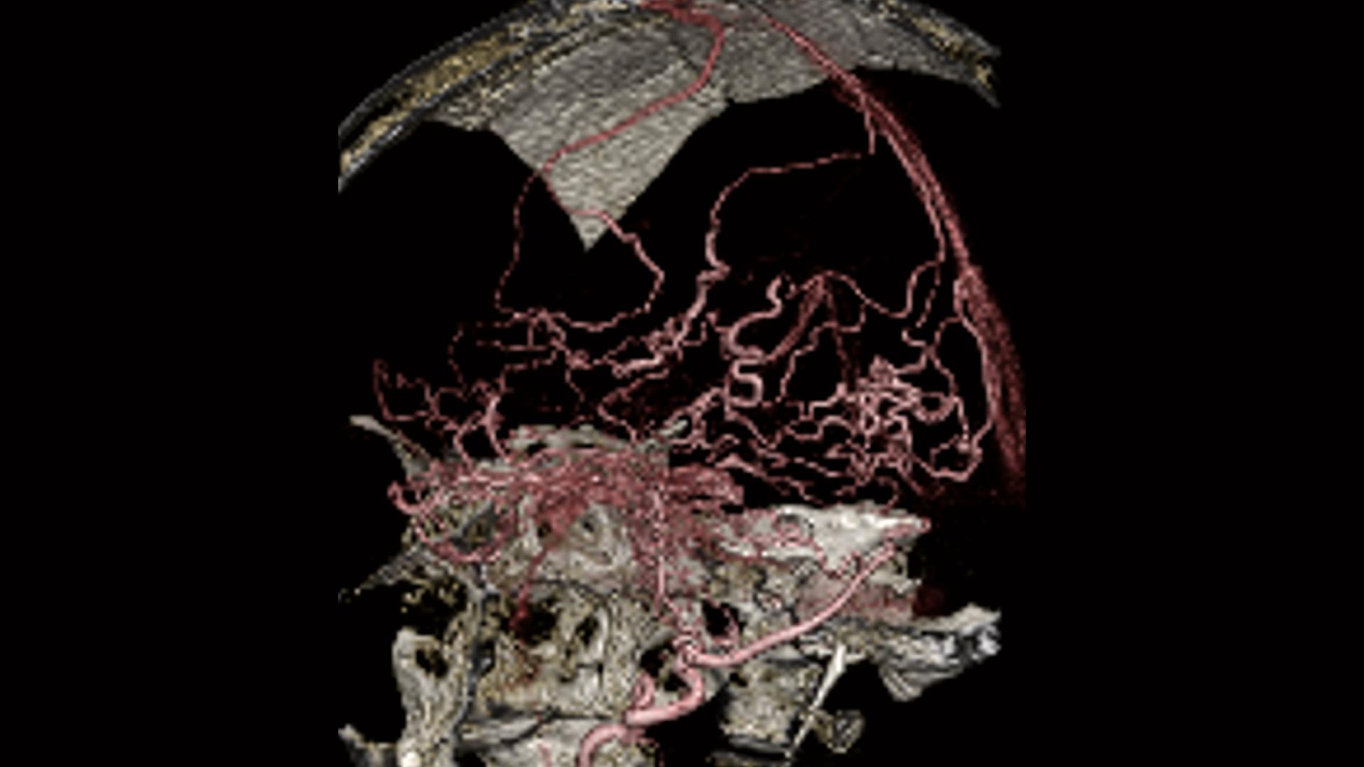 Artis Q - Siemens Healthineers