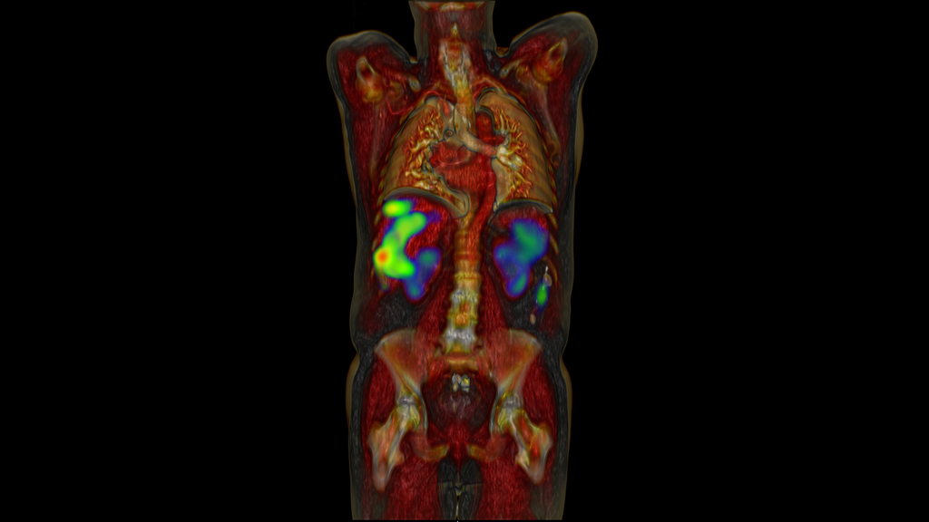 Molecular Imaging Systems - Siemens Healthineers USA