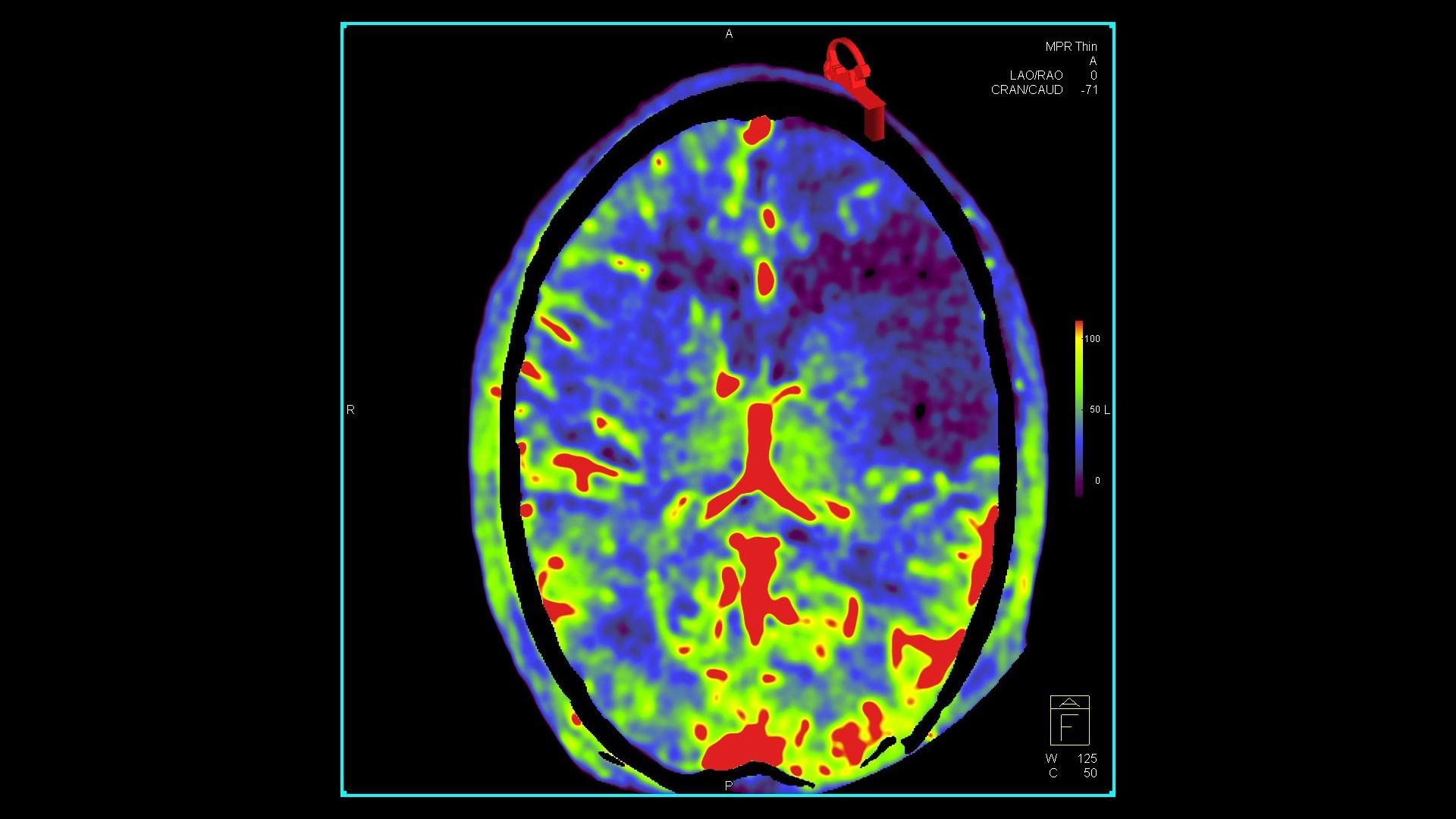 Angiography - Clinical Software Applications - Siemens Healthineers