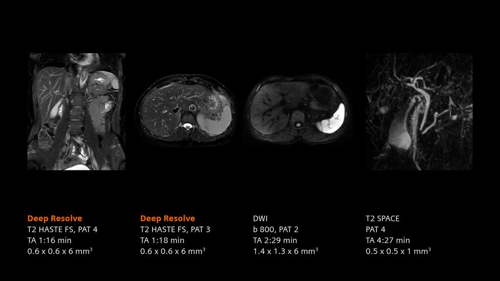 MAGNETOM Flow.Ace - Siemens Healthineers France
