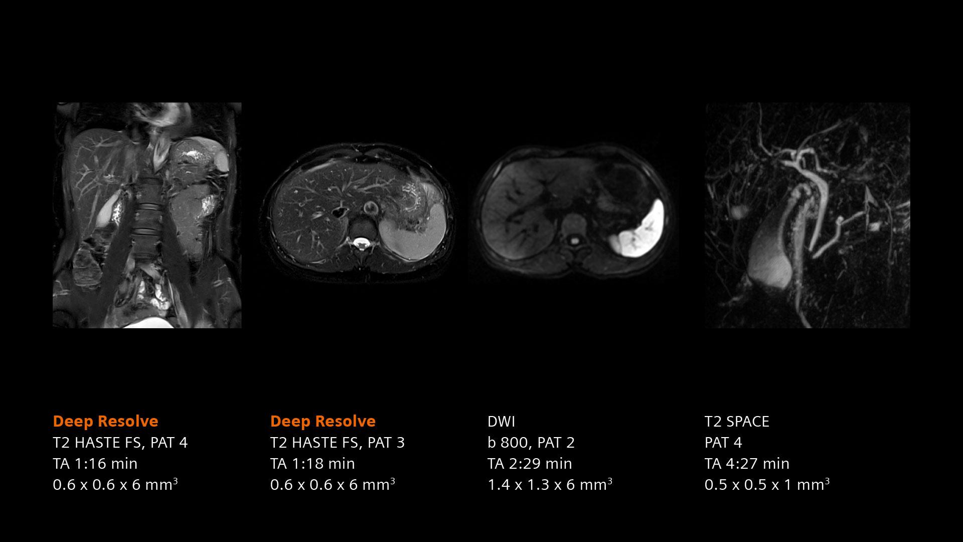 MAGNETOM Flow.Ace - Siemens Healthineers France