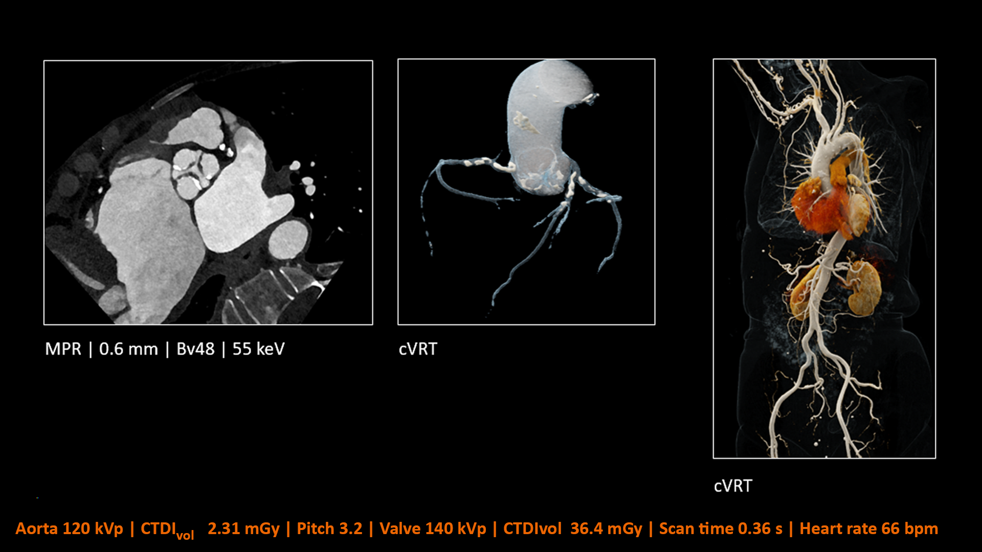 Dual Source CT - Siemens Healthineers