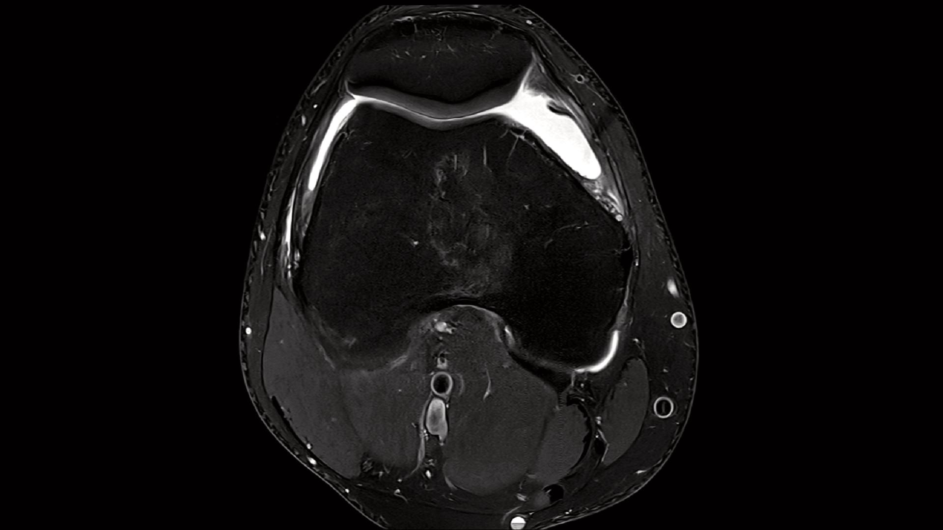 MAGNETOM Cima.X - Make the difference. - Siemens Healthineers