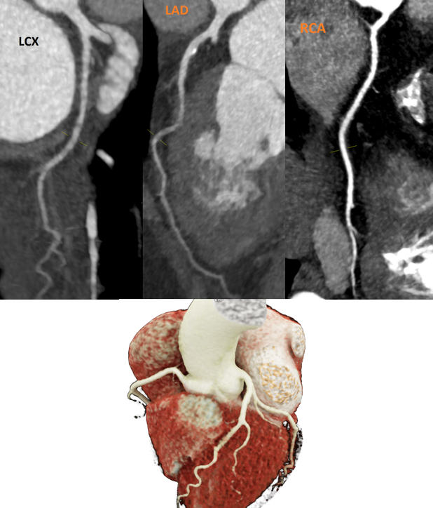 The spectrum of Cardiothoracic CT imaging – Case discussion with dual ...